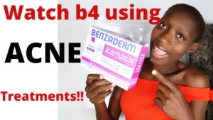 Descubre los beneficios de Benzaderm para tu salud | Botica Farmacia